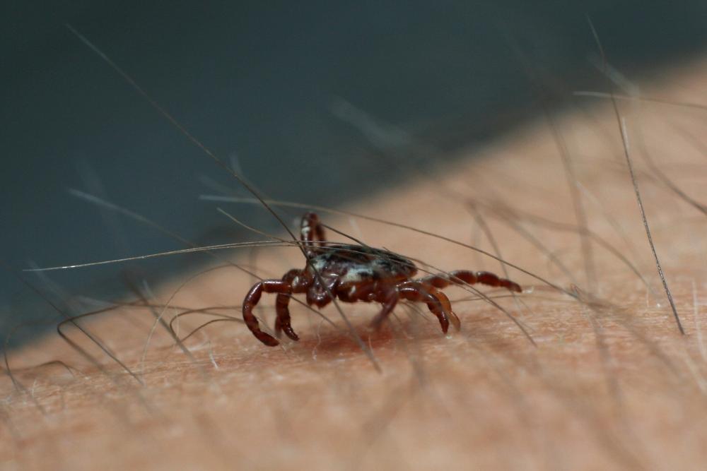 Suburbs See Uptick In Ticks | Radio Boston