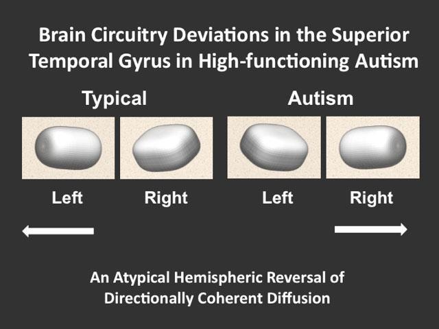 Doctors Tout 'Most Promising Ever' Biological Autism Test | WBUR News