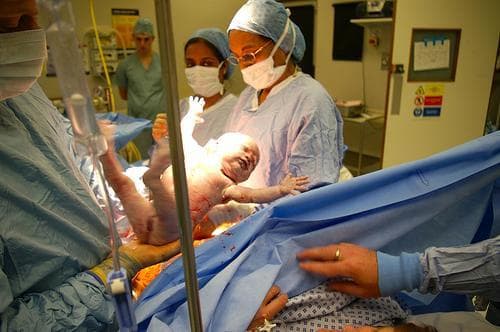 Will The C-Section Rate Soon Hit 50 Percent? | WBUR News