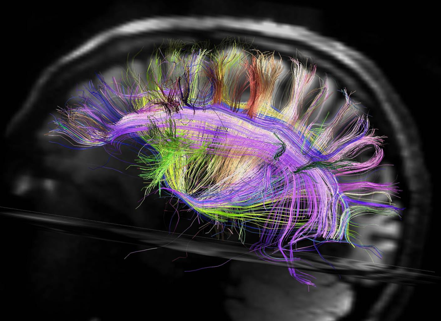 Study: Brain Connections Like Woven Fabric, Not Tangled Spaghetti ...