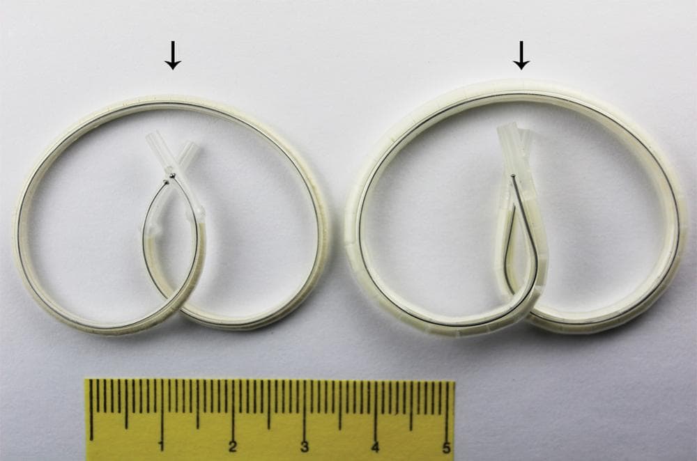 A New Device For A Chronic Bladder Problem | WBUR News