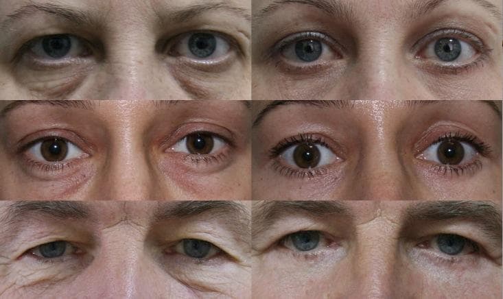 Beyond 'Before And After:' The Subtle Scoop On Cosmetic Surgery | WBUR News