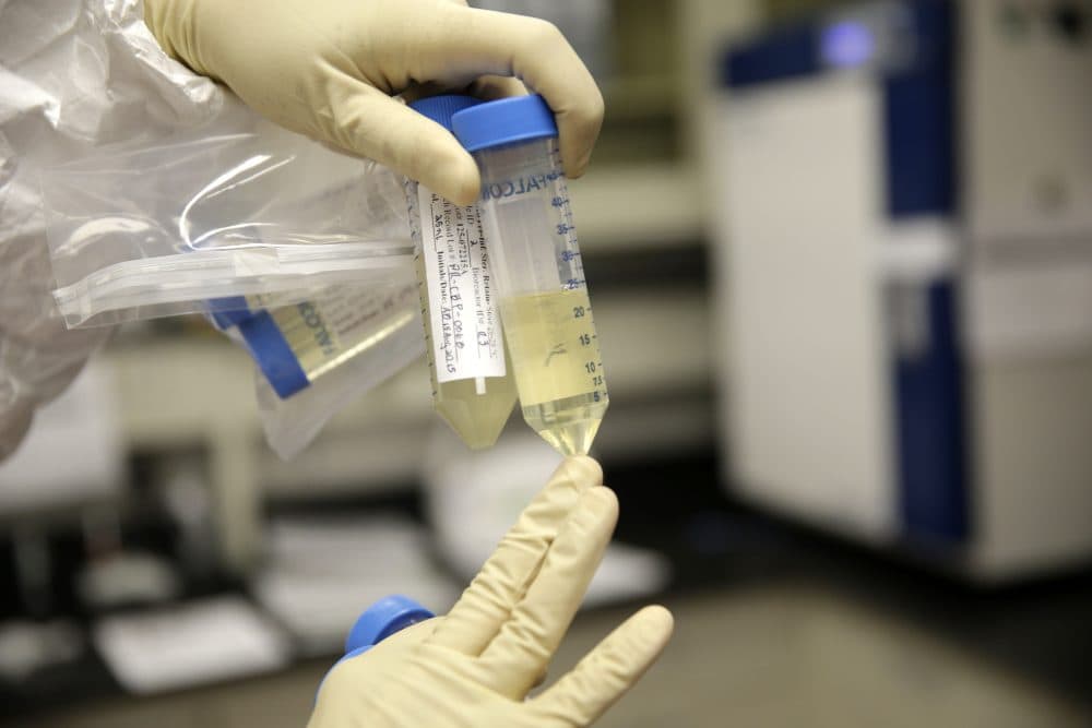 U.S. Flu Season Off To Early Start; Widespread In 7 States, Including ...